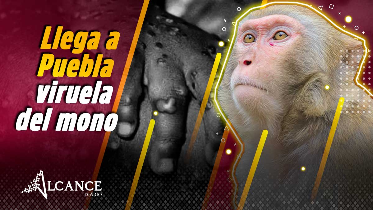 Confirman los primeros dos casos de viruela del mono en Puebla